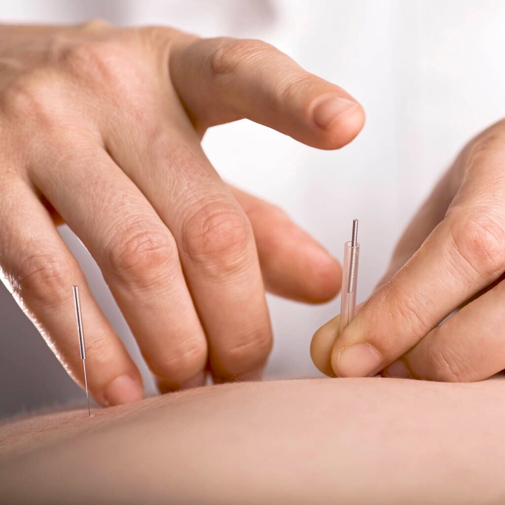 Shamrock Acupuncture Round Rock